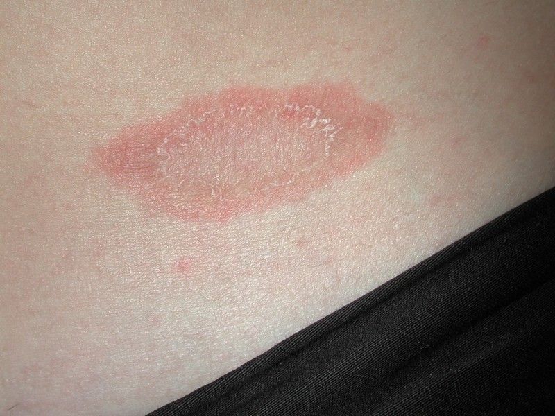 Quiz journées dermatologiques